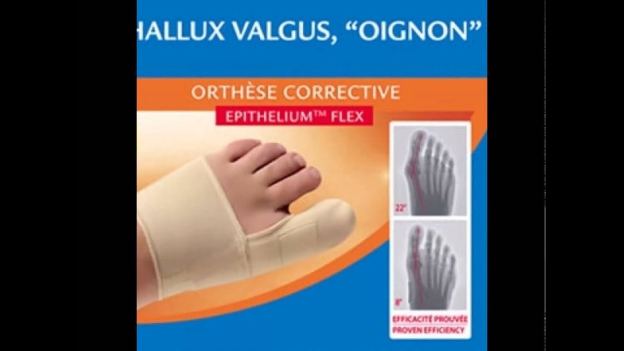 Orteze pentru monturi maini si picioare - YouTube