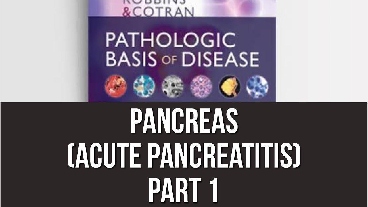 Acute Pancreatitis || pancreas || part 1 || Special pathology - YouTube