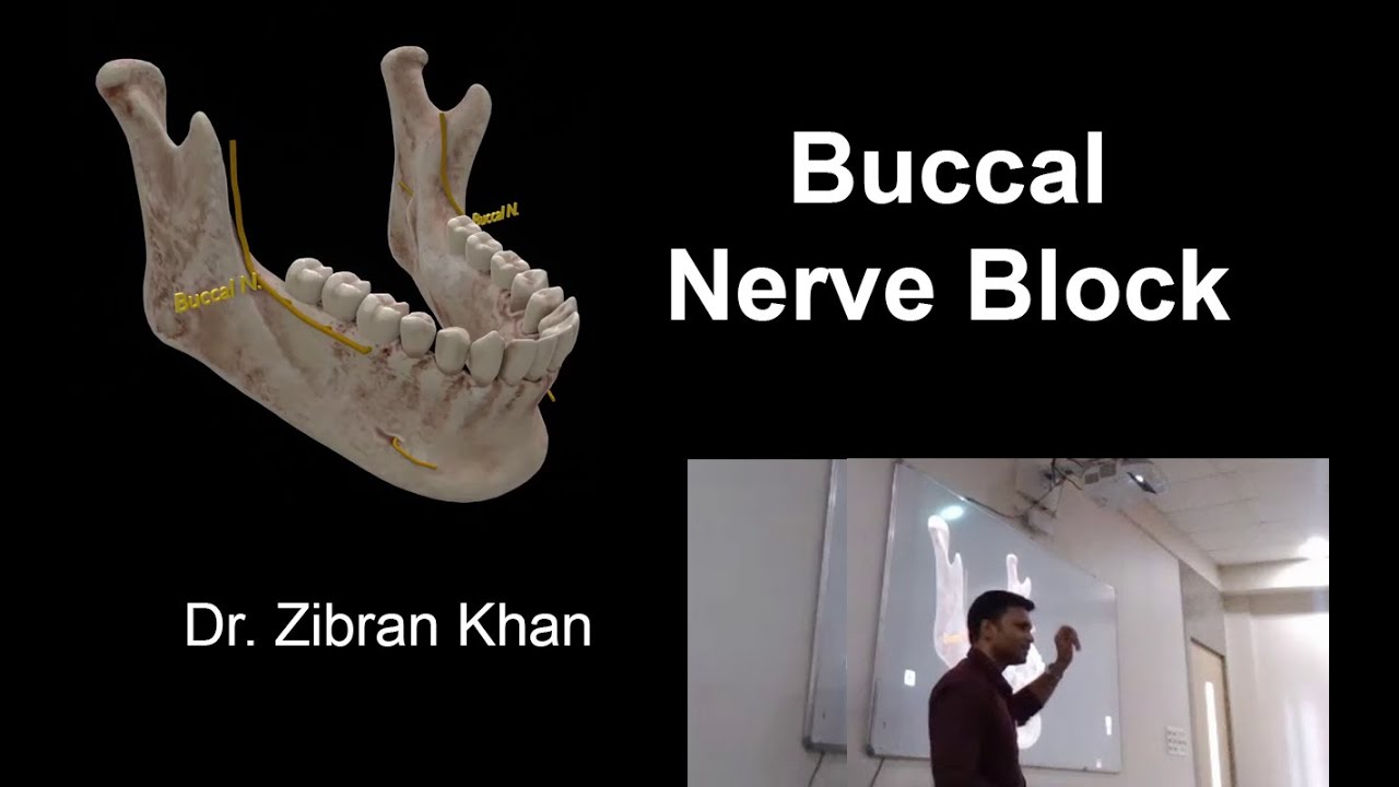 Buccal Nerve Block - YouTube