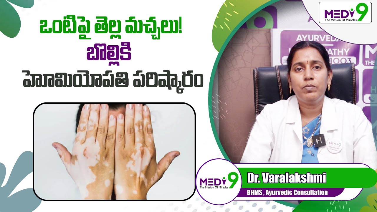 (Bolli Machalu)Symptoms of Vitiligo Disease & Treatment | Skin White ...