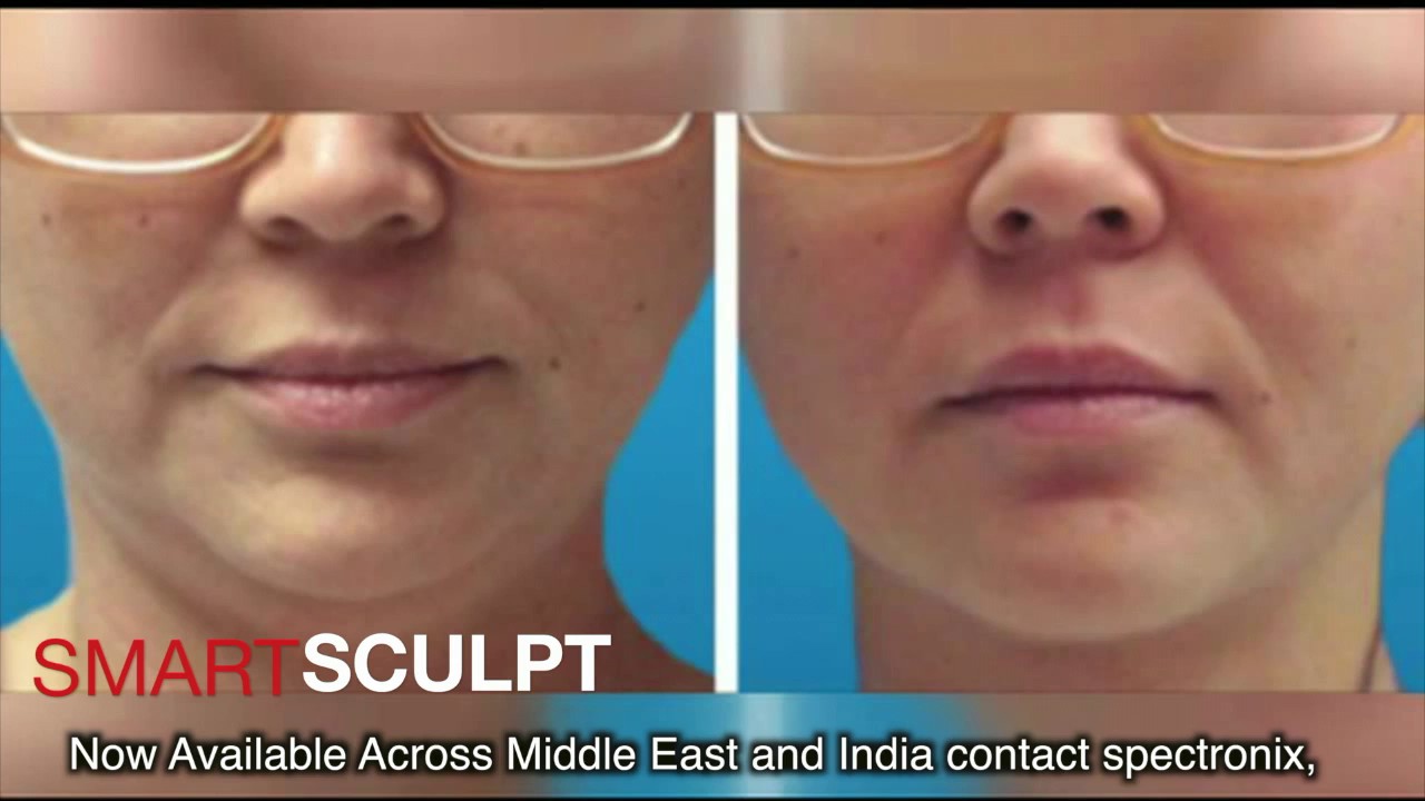 Smart Sculpt - YouTube