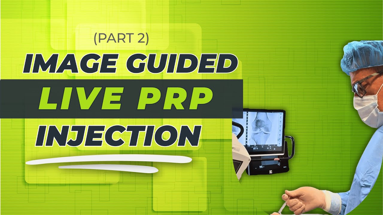 What actually happens during a knee PRP injection procedure 2 -- Get ...