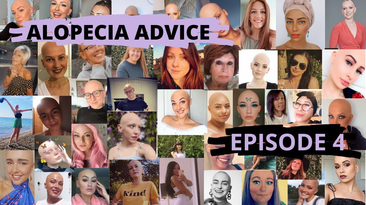 ALOPECIA SUPPORT SERIES - EPISODE 4: OUR ADVICE TO YOU / COPING WITH ...