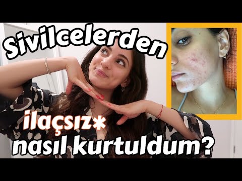 SİVİLCELERDEN İLAÇ KULLANMADAN NASIL KURTULDUM? Hızlı ve kalıcı olarak sivilce ve lekeye çözüm!