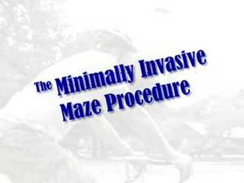 Mini-maze Minimally Invasive Procedure
