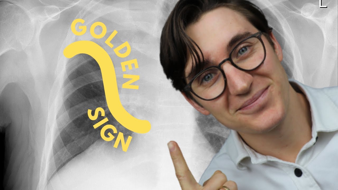 The Golden S Sign - EXPLAINED - YouTube