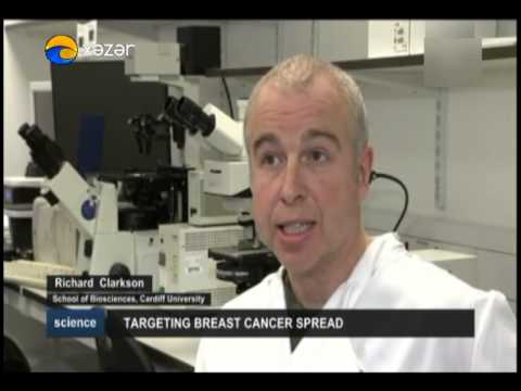 Xərçəng xəstəliyi