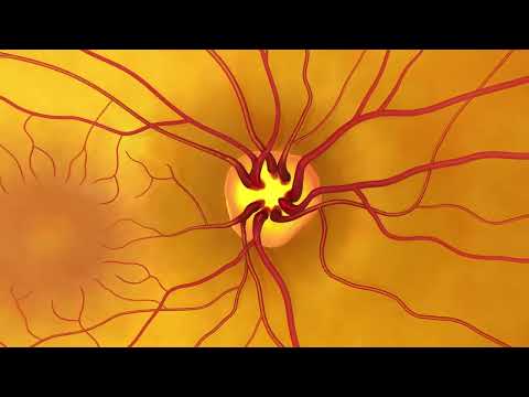 Animation: Dilated Eye Exam - YouTube