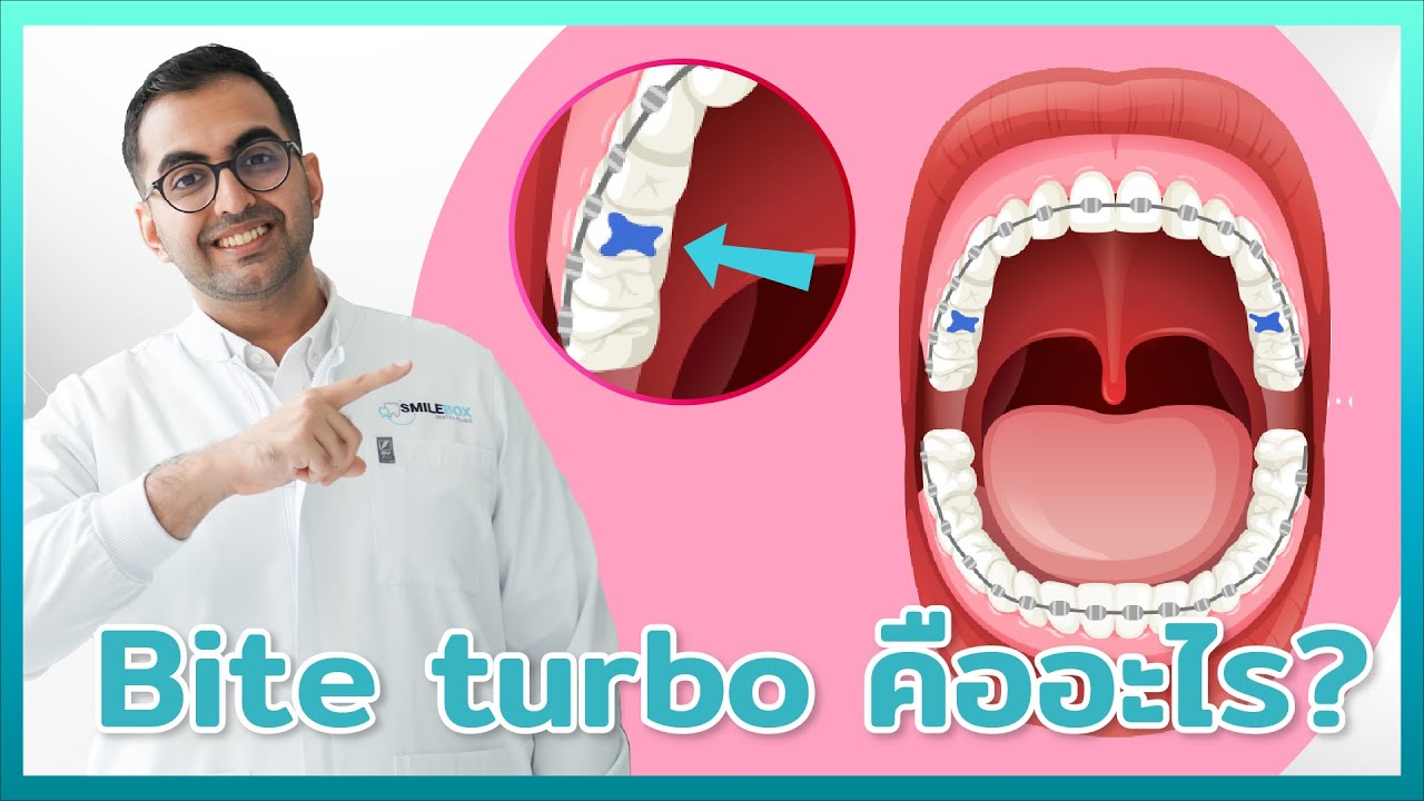 Bite Turbo คืออะไร⁉️ I หมอฟัน SmileBox - YouTube