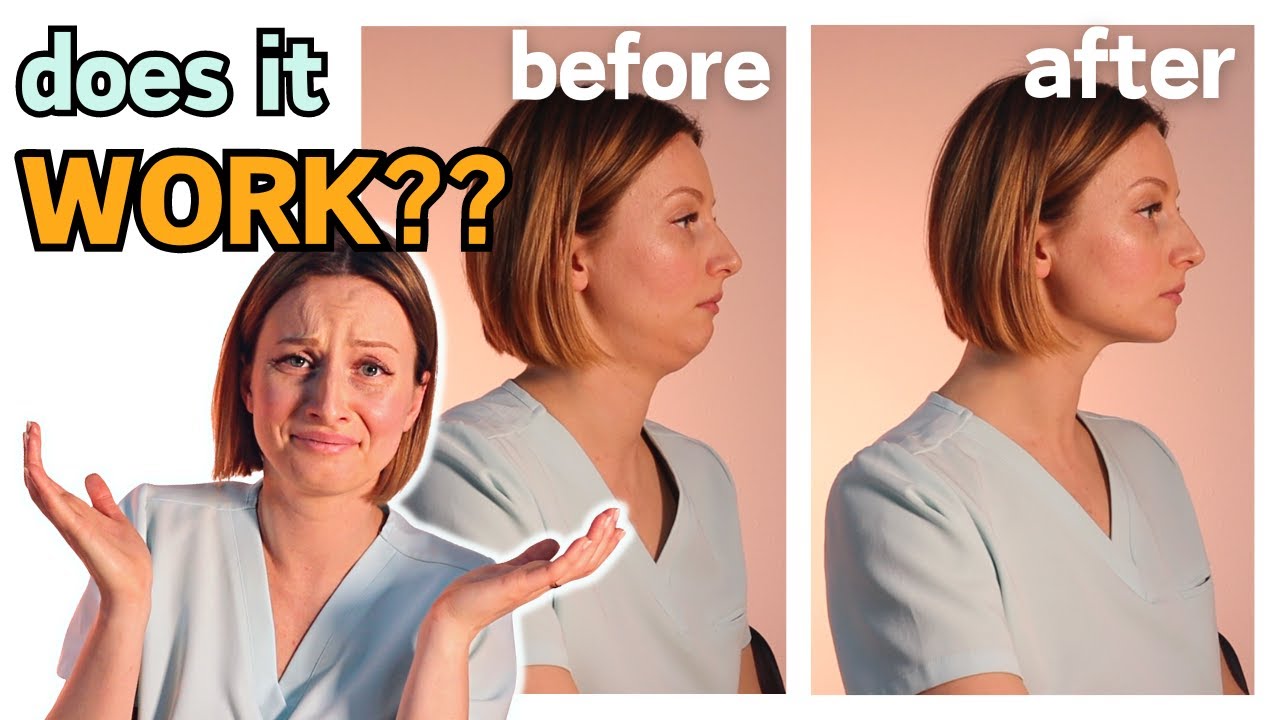 What is Mewing, and does it work? - YouTube