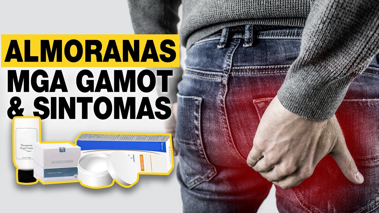 Mga Gamot sa Almoranas na Mabibili sa Botika | Mga Uri ng Almoranas at ...