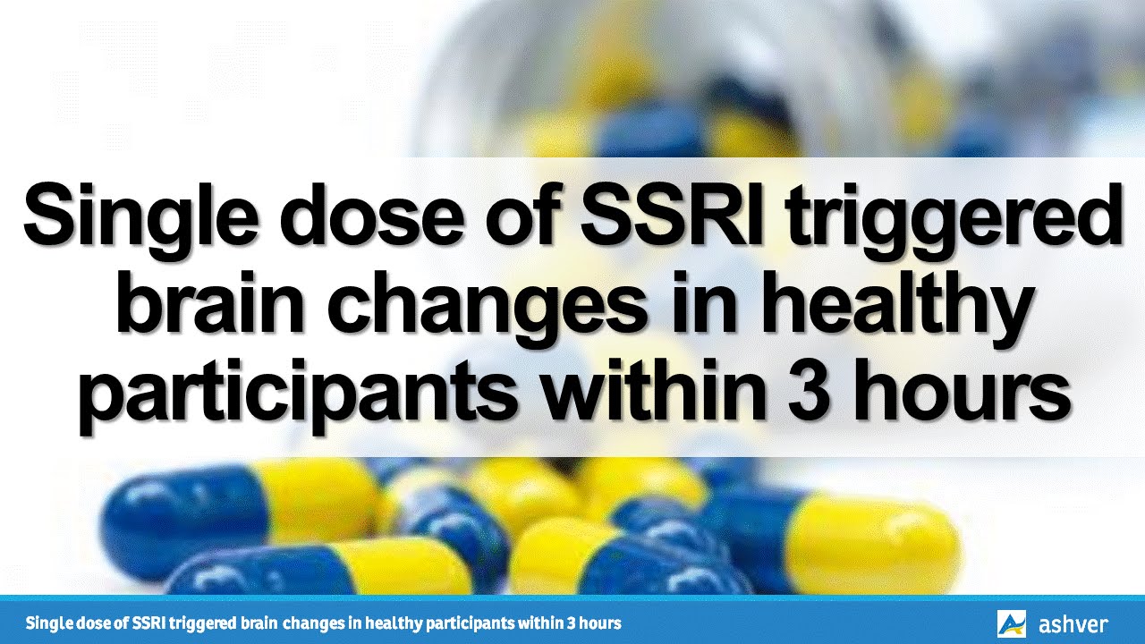 Single dose of SSRI triggered brain changes in healthy participants ...