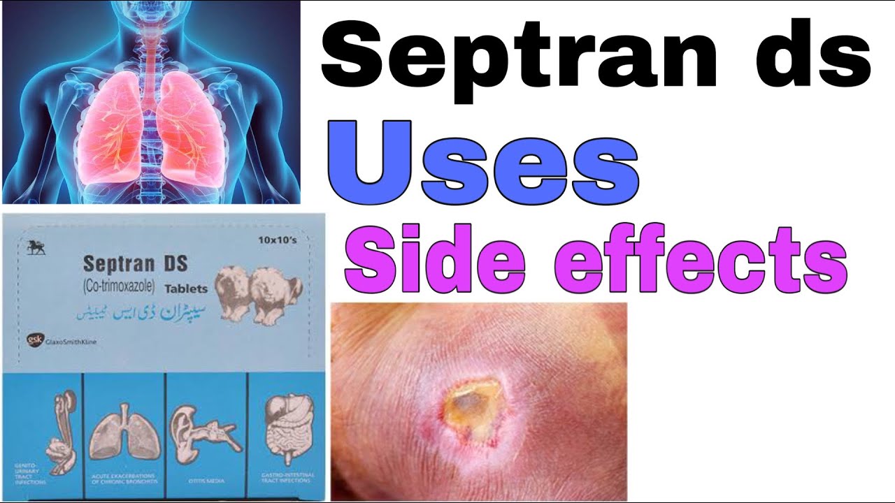 Septran ds tablets | how to use Cotrimoxazole | uses | side effects ...