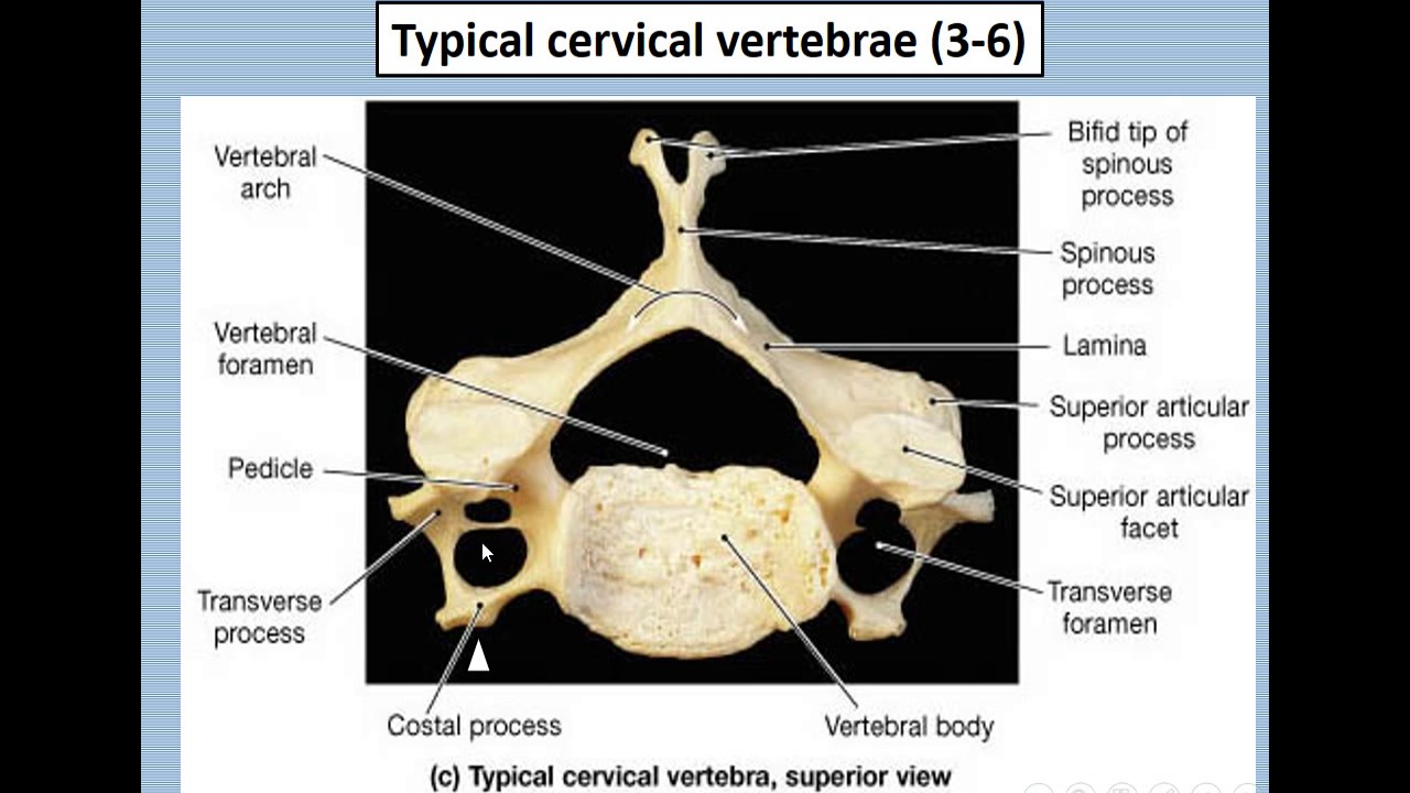 Typical Lumbar Vertebra