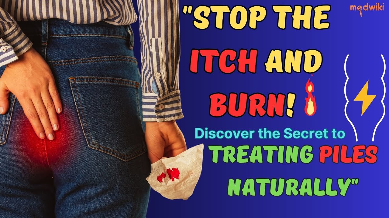 Stop the Itch and Burn! Discover the Secret to Treating Piles Naturally ...