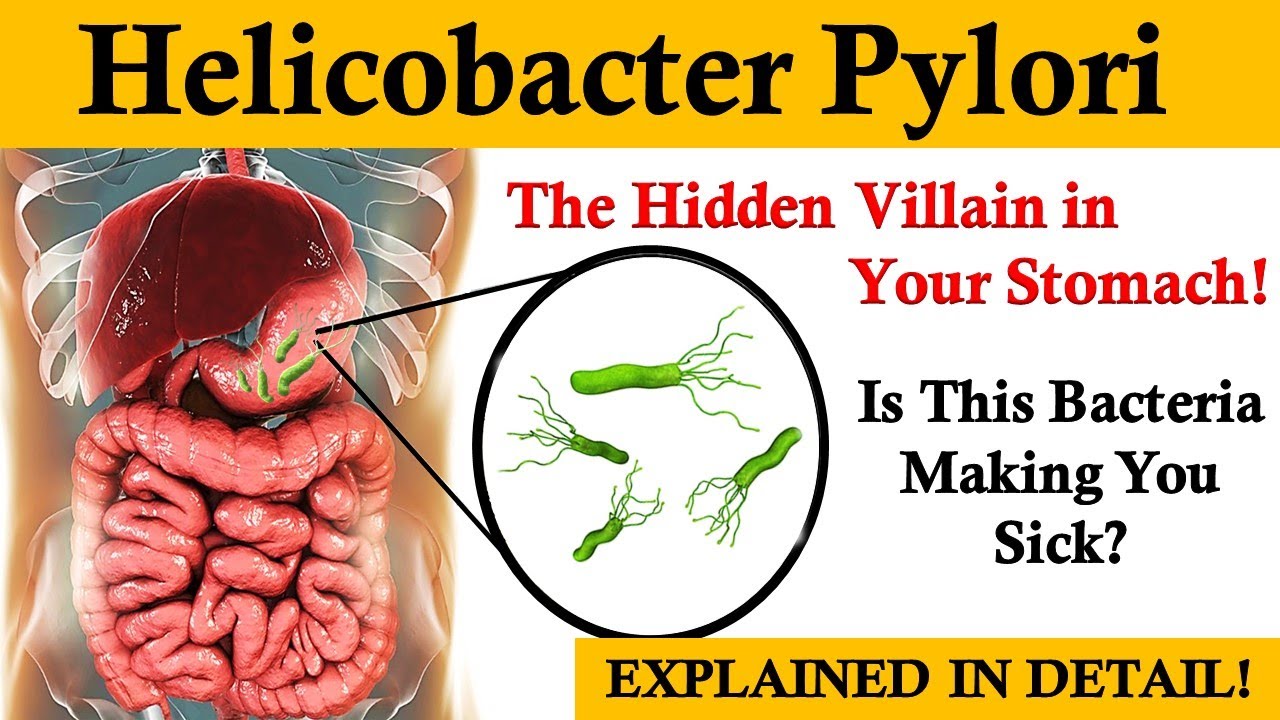 Helicobacter Pylori (H.Pylori), Definition, Causes, Sign & Symptoms ...
