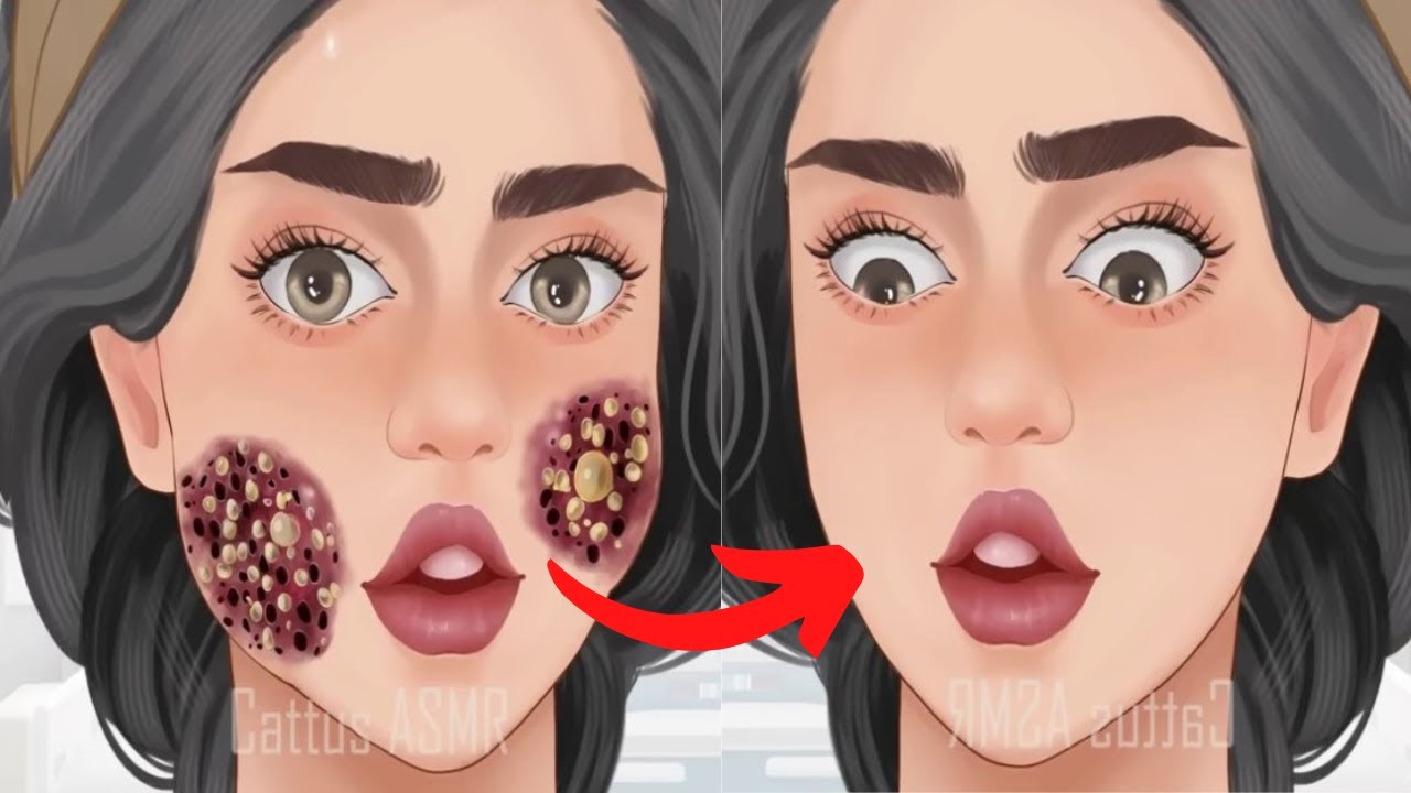 ASMR infection face treatment from octopus ASMR infection face ...