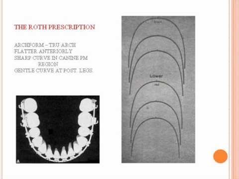 straight wire technique / Indian Dental Academy - YouTube