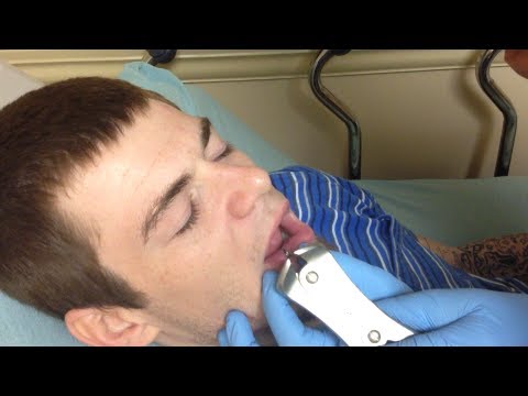 Lip Ring Stuck - YouTube