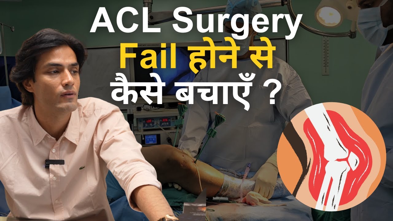 ACL Surgery Fail होने सेकैसे बचाएँ ? How you can Prevent ACL Surgery Graft Failure - YouTube