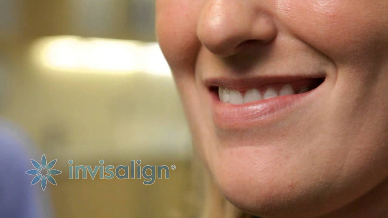 Commercial Invisalign No Offer - YouTube