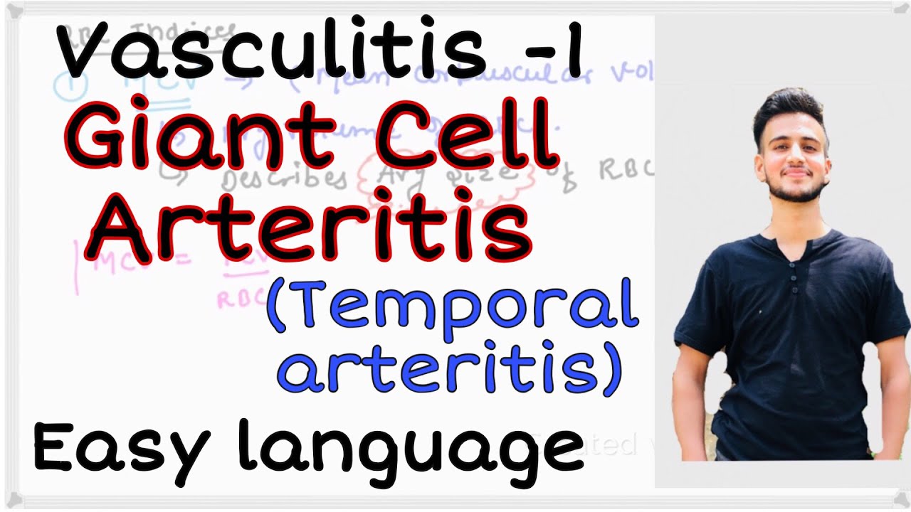 Giant cell Arteritis(Temporal arteritis) /Vasculitis Pathology # ...