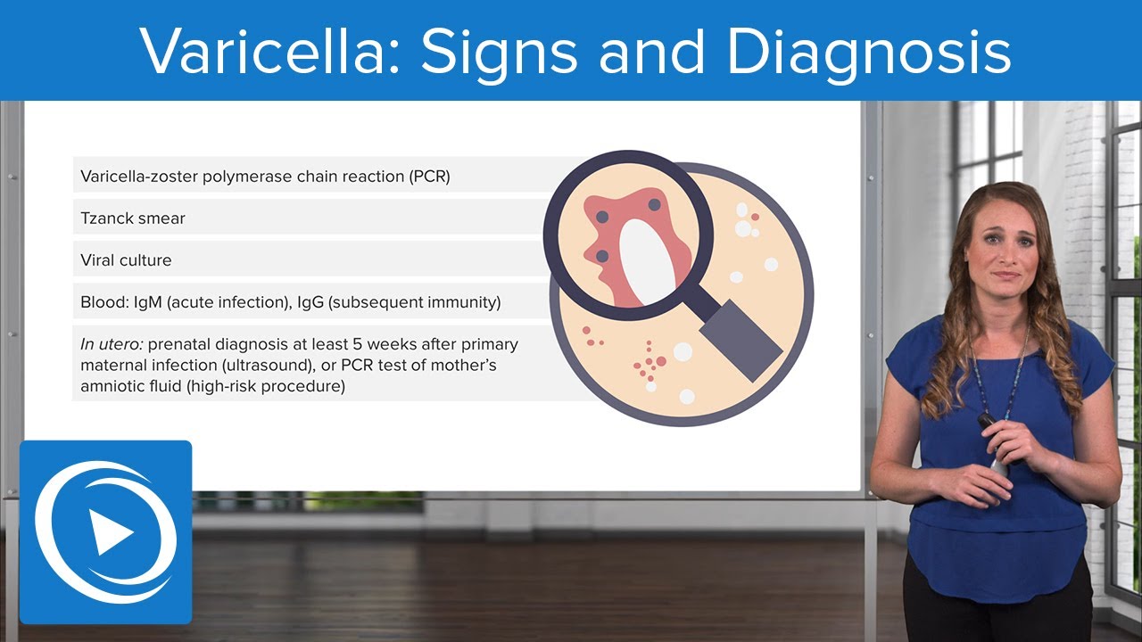 Varicella: Signs and Diagnosis – Pediatric Nursing | Lecturio Nursing ...