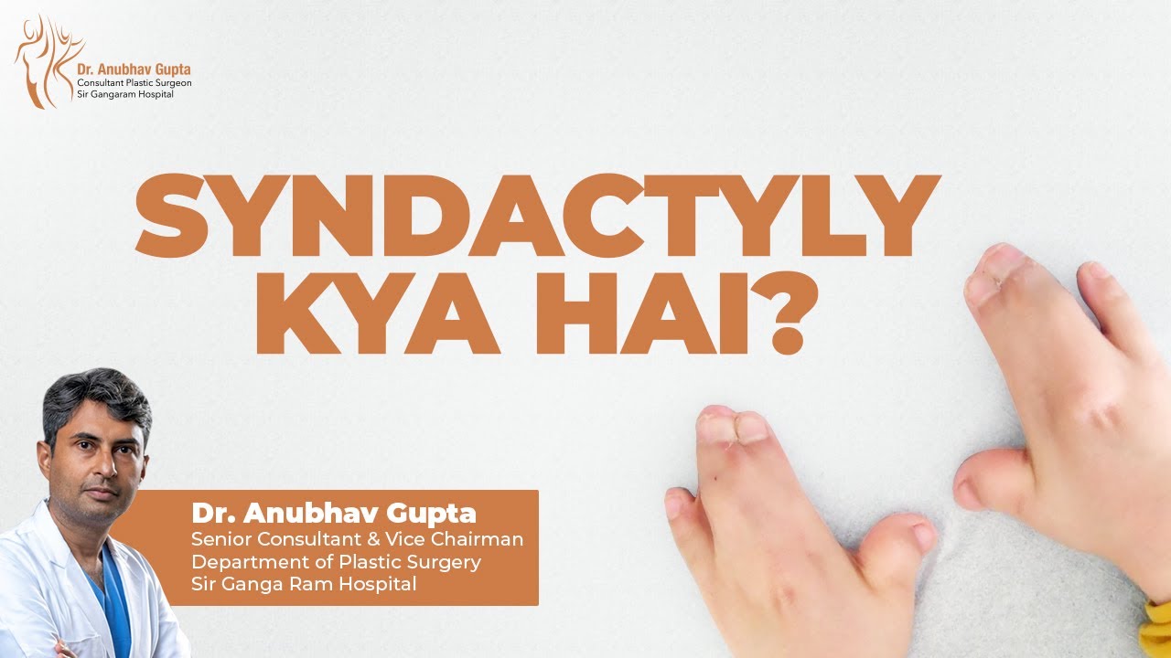 What is Syndactyly? | Causes, Types, Diagnosis, and Treatment Explained ...