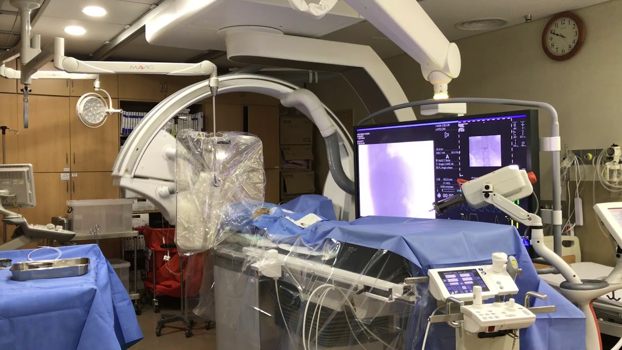 SIEMENS Dyna CT - YouTube