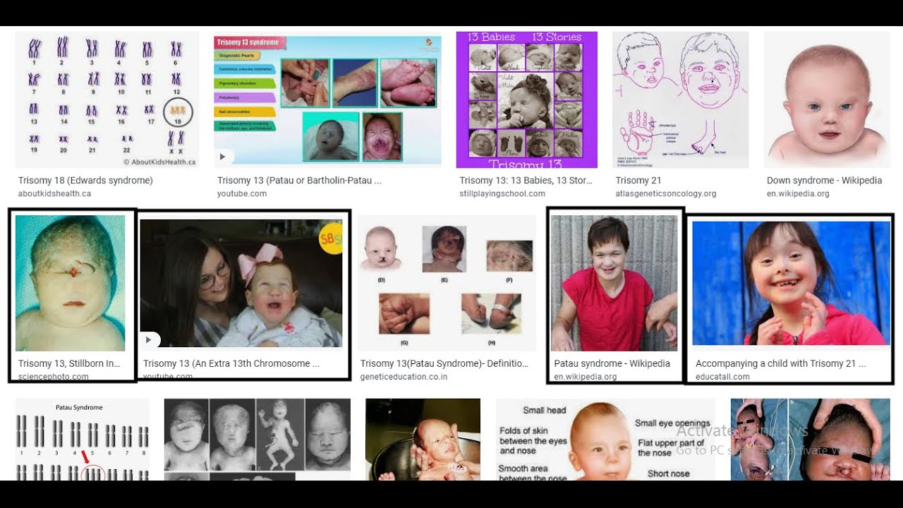 Aneuploidy-3: Tetrasomy (Chromosomal Mutations) by JJS SIr for Class 12 ...