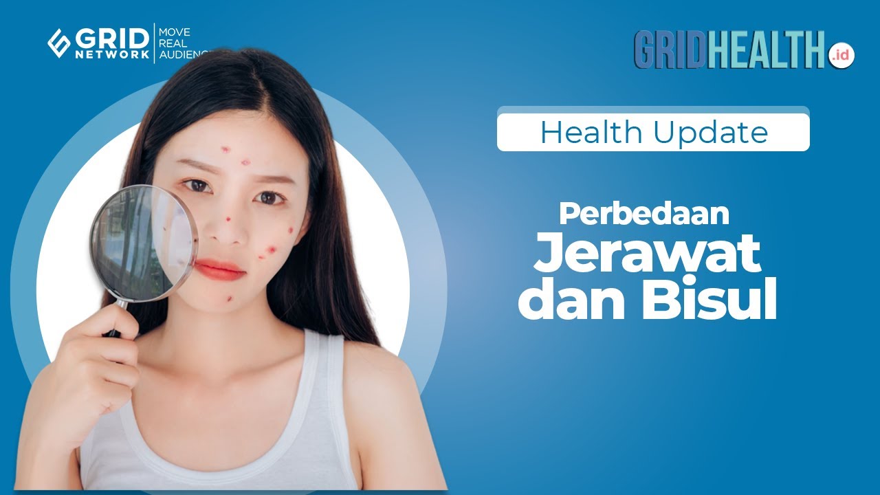 Sekilas Tampak Sama, Ternyata Jerawat dan Bisul Memiliki Ciri Khas yang ...