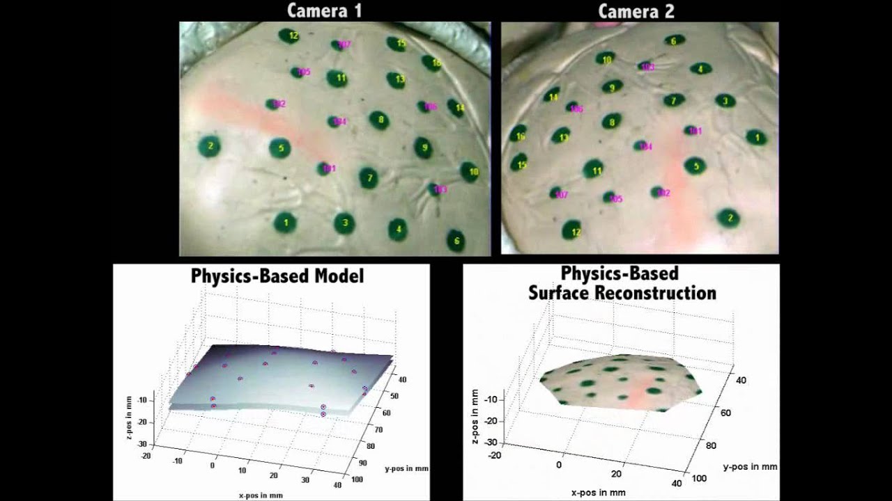 Tracking and Visual Stabilization of Beating Heart - YouTube