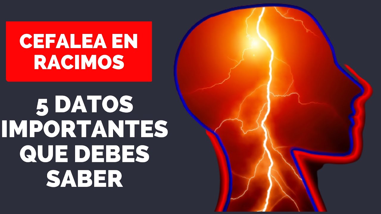 CEFALEA EN RACIMOS: 5 Datos Importantes Que no Debes Pasar Por Alto ...