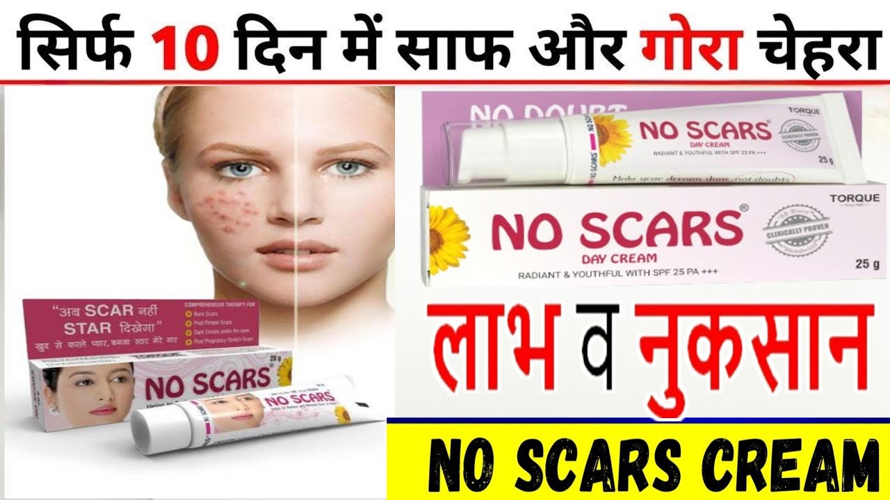No Scars Cream Review || how to use no scars cream || 2025 || - YouTube