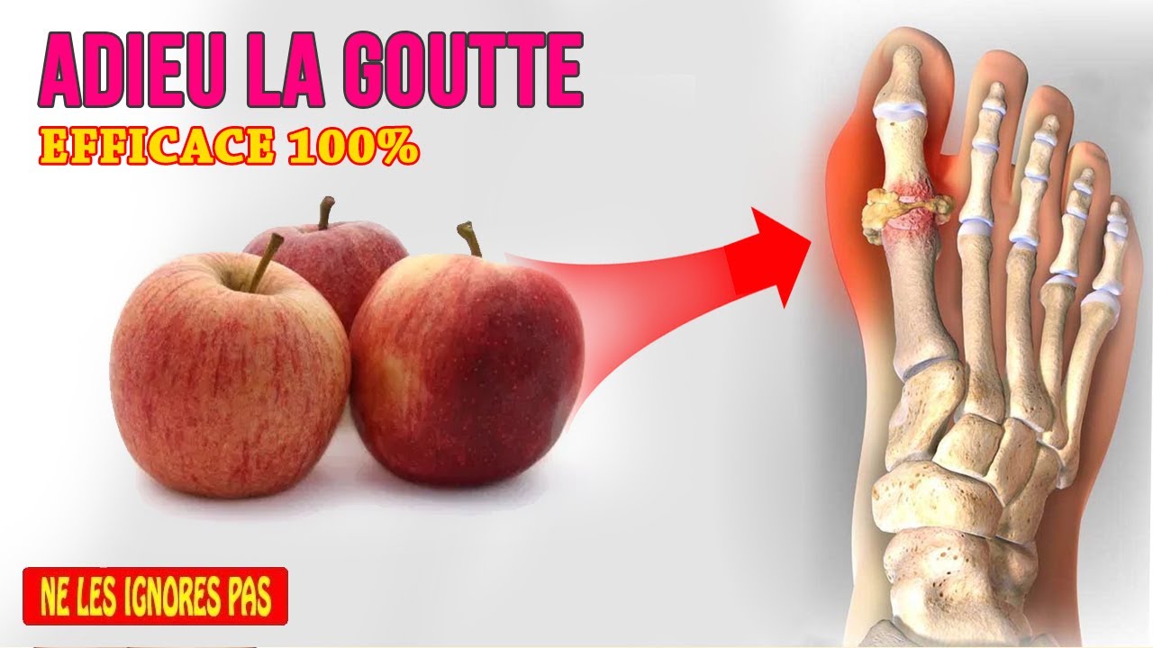 Ce Remède Naturel Pour Réduire Les Douleurs De La Goutte Rapidement ...