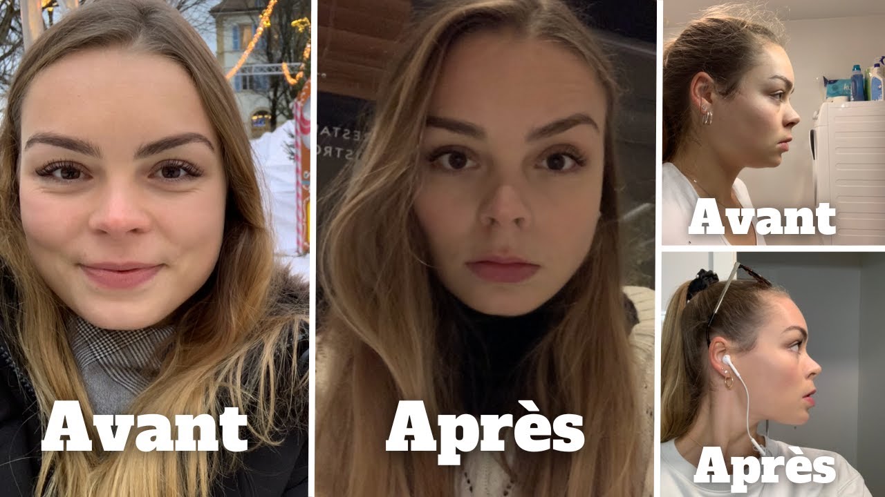 MINCIR du visage en seulement quelques heures (sans perte de poids) 👉 ...