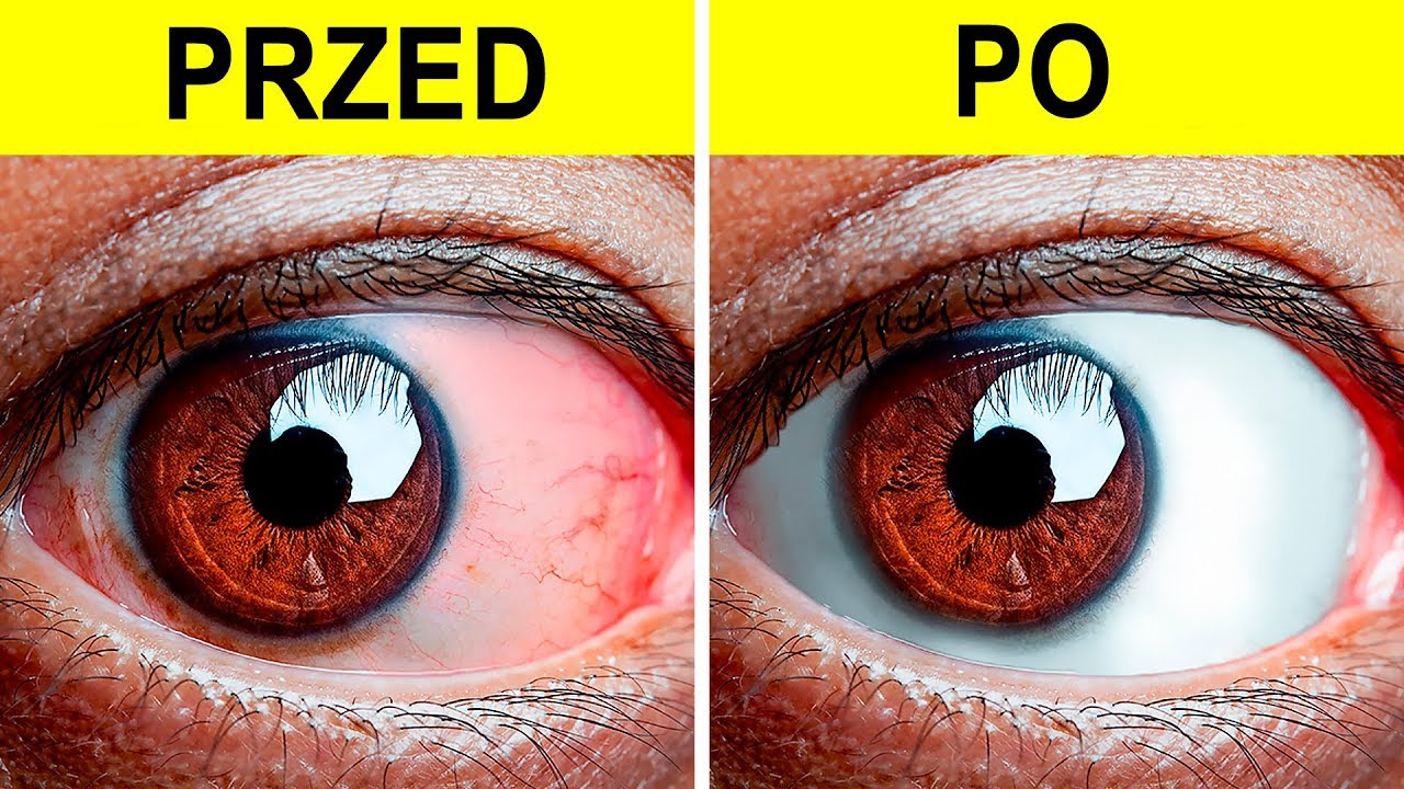 14 ćwiczeń na zmęczone oczy - YouTube