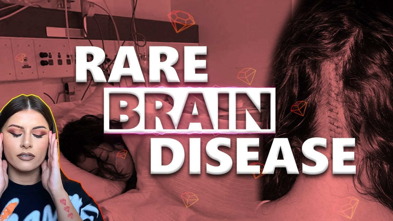 My Rare Brain Disease - YouTube