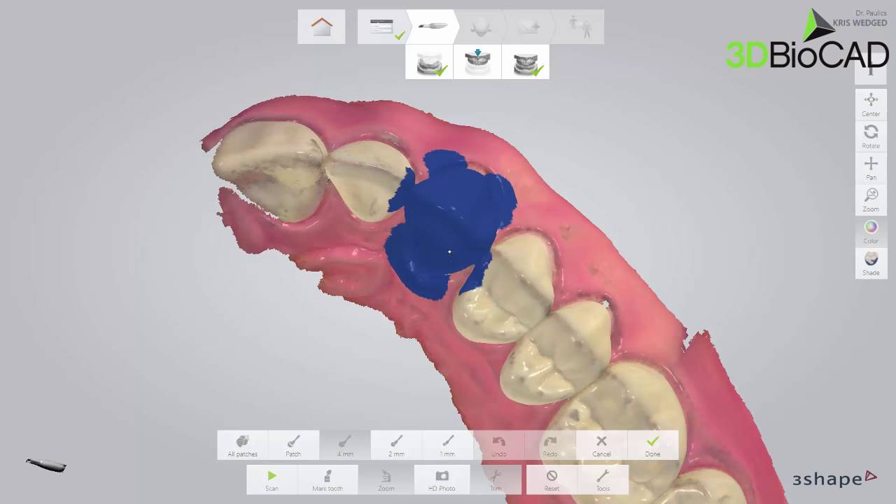 3D BioCAD - TRIOS 3 How to utilize Preprepration Copy Function - YouTube