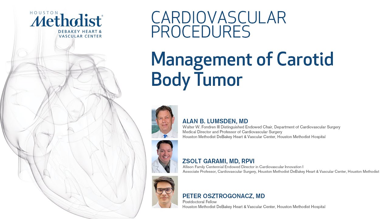 Management of Carotid Body Tumor - YouTube
