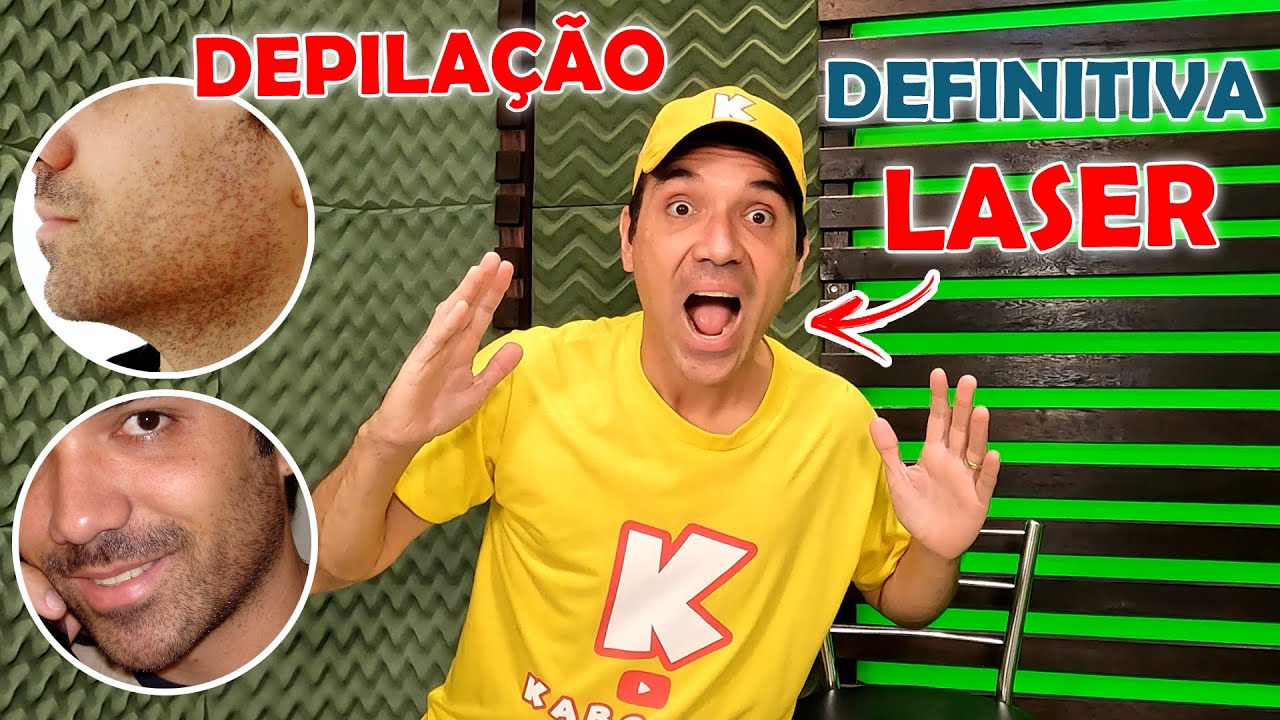 DEPILAÇÃO DEFINITIVA A LASER BARBA COMPLETA! - YouTube