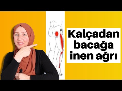 Priformis Sendromu: Kalça Ağrısının Gizli Sebebi