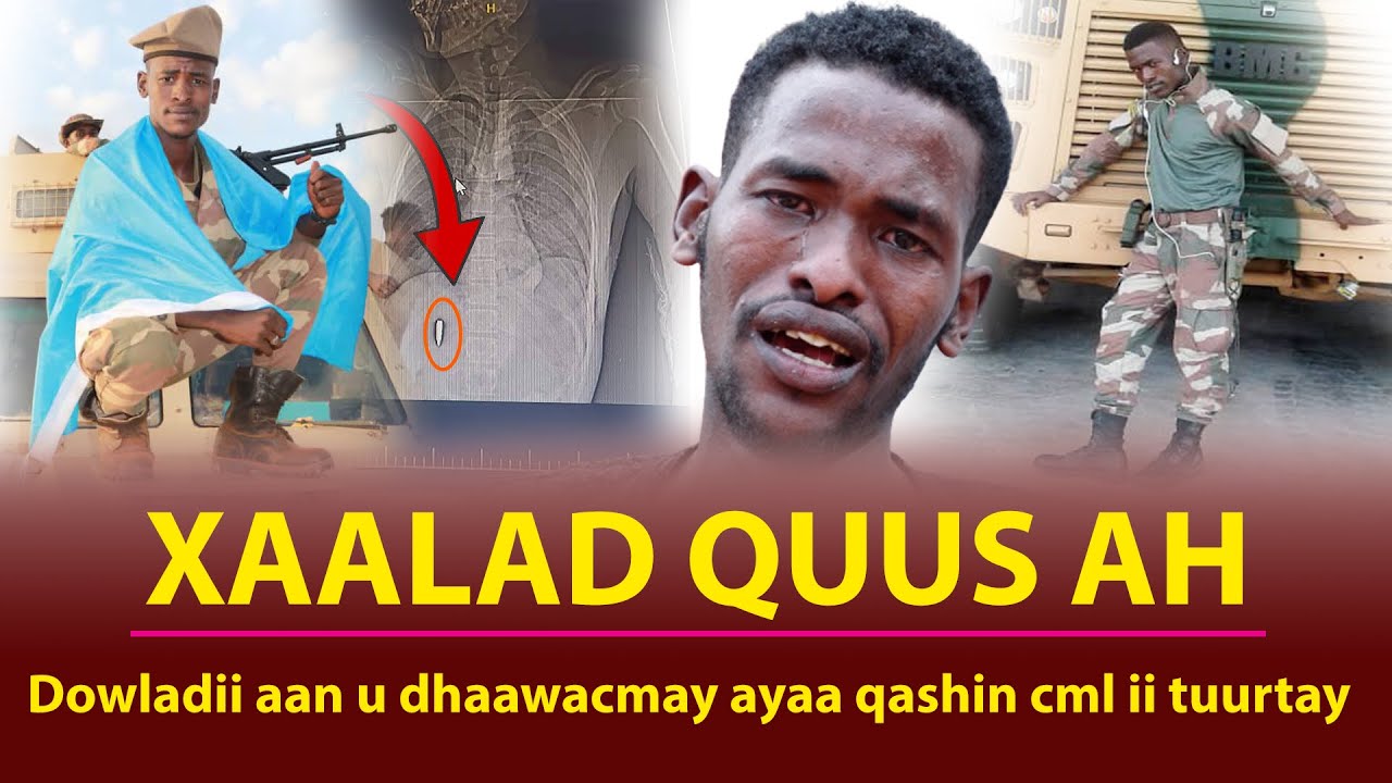 Xaalad Quus ah ! Dowladii aan u dhaawacmay ayaa i dayacday , qashin ...