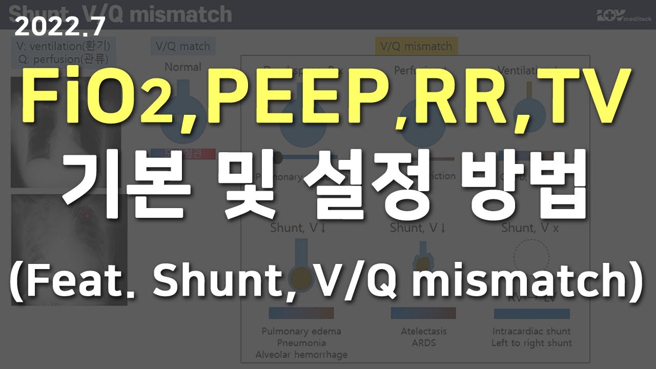FiO2, PEEP, RR, TV 기본 및 설정방법 (Feat. shunt(단락), V/Q mismatch(환기관류불균형 ...