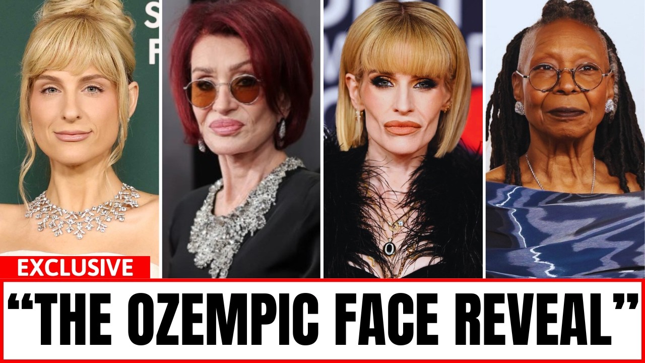 15 Shocking Ozempic Celebrity Transformations You Can’t Unsee | Then ...