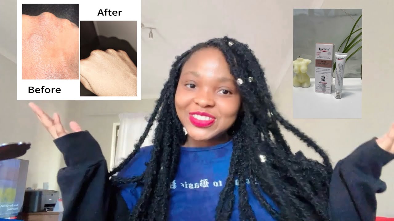 My skin journey *how I cured my eczema with photo evidence before and ...