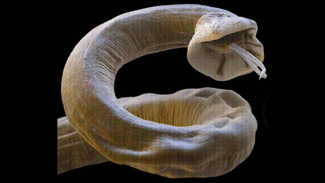 "Autobiography of a Lungworm" by Roy Fuller (read by Tom O'Bedlam ...