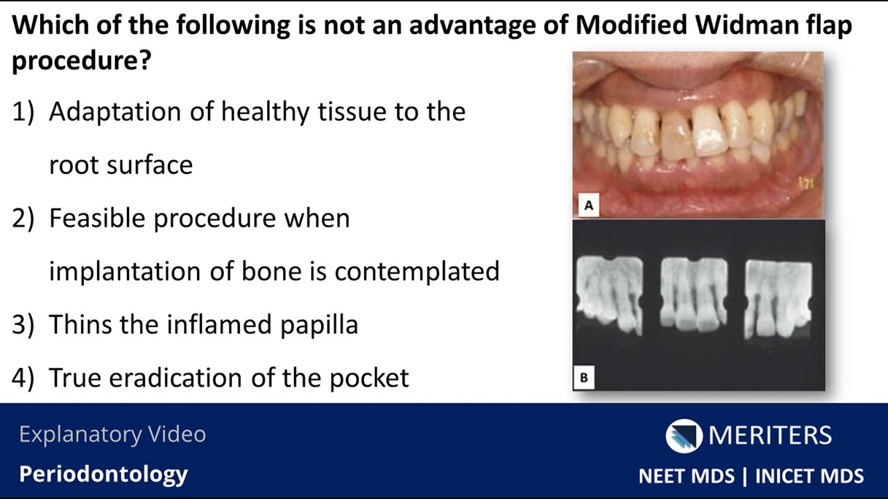 NEET MDS | INICET - Periodontology - Flap & Mucogingival Surgery ...