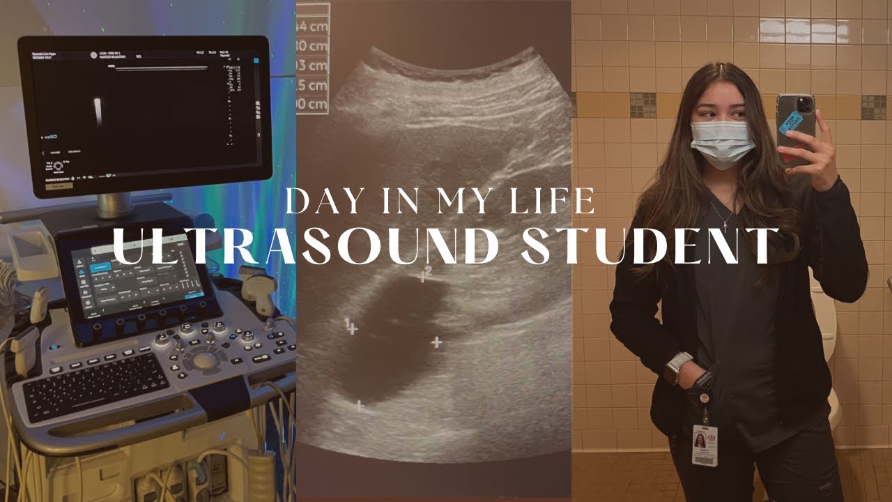Day in my life as an ULTRASOUND STUDENT - YouTube