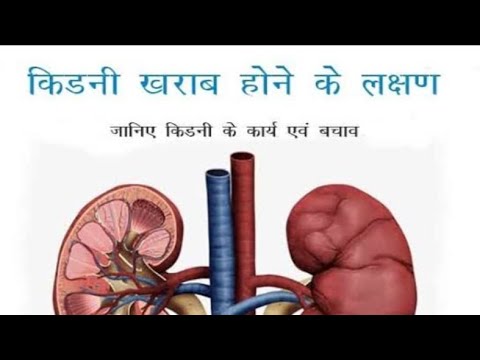 Dr. Shiv Chadha ने बताया Kidney खराब होने के लक्षण , कारण और इलाज ...